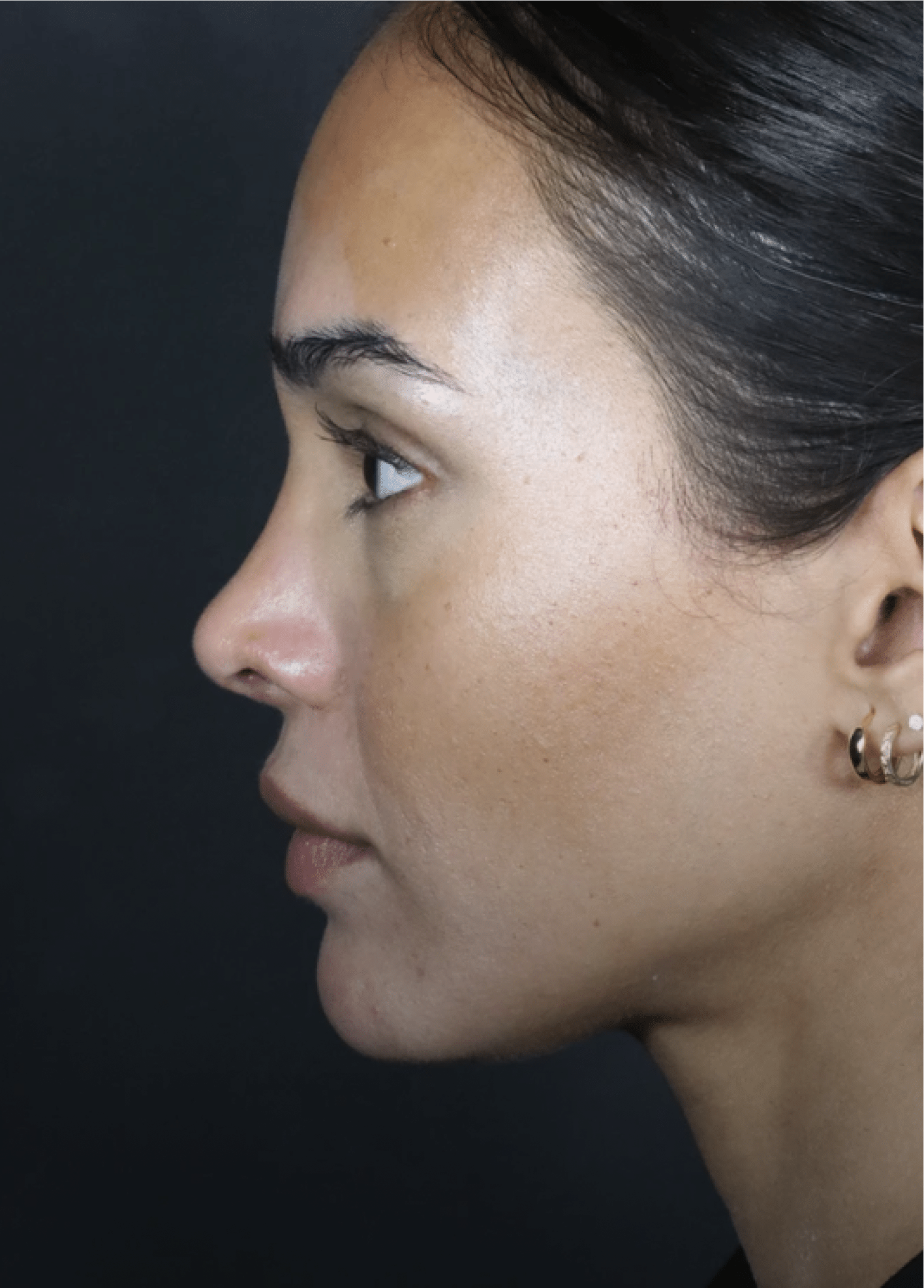 Procedure Simulator | Noses and Necks NYC